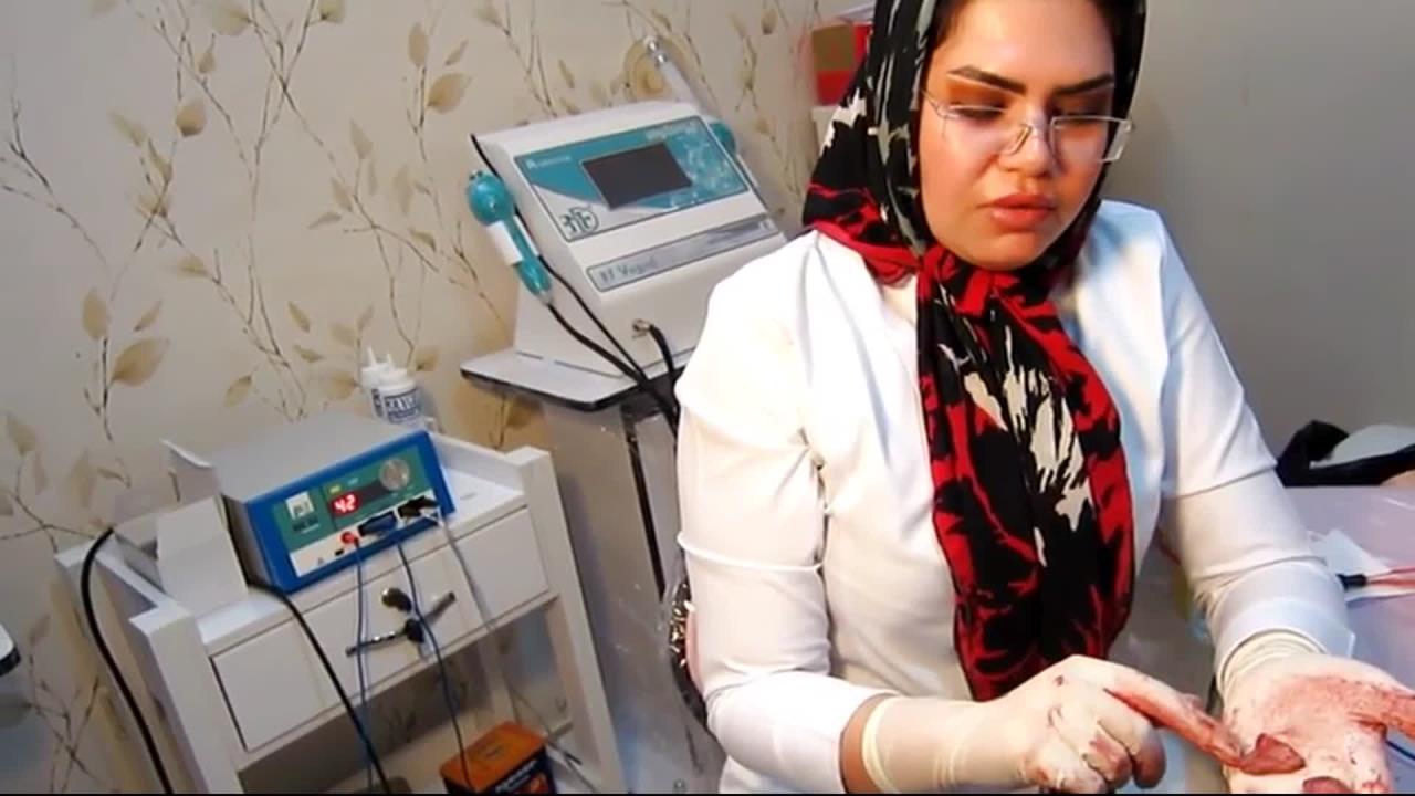 عمل لابیاپلاستی در مشهد Labiaplasty In Mashhad دکتر اذر اشکذری جراح و